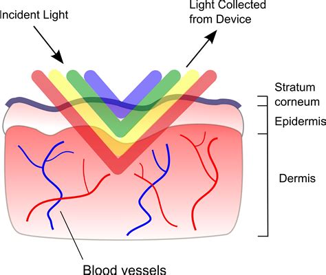Figure Operating Principle Miravex