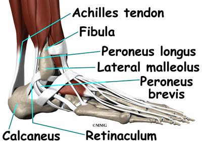 Peroneal Tendon Subluxation 네이버 블로그