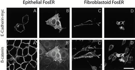 transient expression of ectopic e cadherin epithelial and