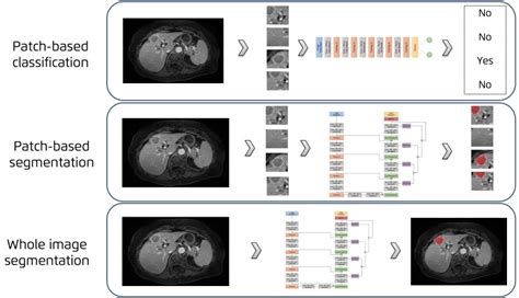 AI Experts Tackle Organ Segmentation And Health Economics Healthcare In Europe Com