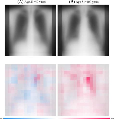 The Future Of Medical Imaging Advanced Ai Can Tell Your True Age By