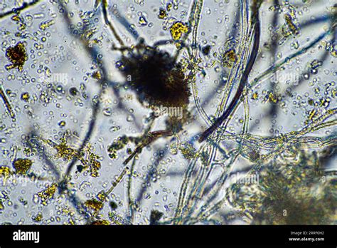 Phytophthora Infestans Microscope