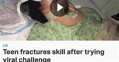 Editing Album On Imgur