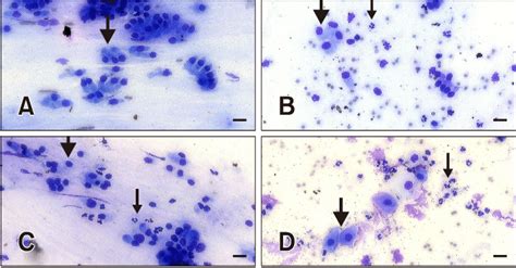 Microscopic Observation Of The Percentage Of Polymorphonuclear Download Scientific Diagram Microscopic Observation Of The Percentage Of Polymorphonuclear Download Scientific Diagram