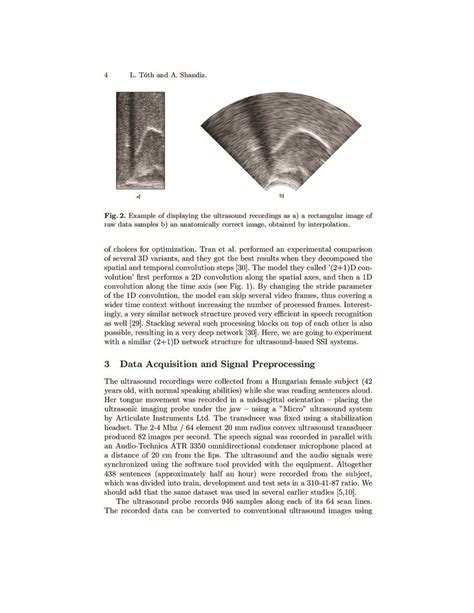 3d Convolutional Neural Networks For Ultrasound Based Silent Speech Interfaces Deepai