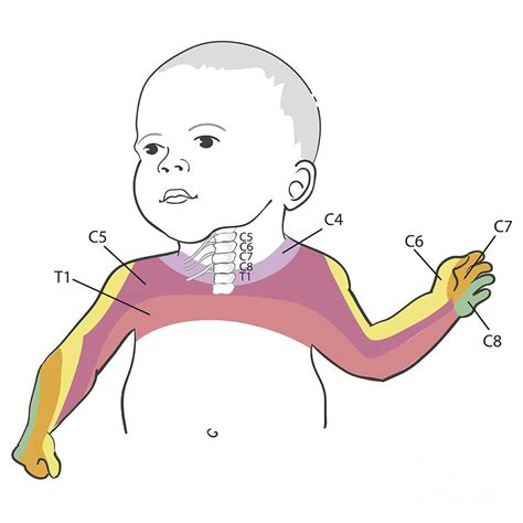 Dermatomes Arm Hand Anatomy
