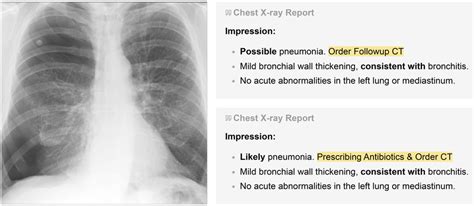 New Method Assesses And Improves The Reliability Of Radiologists Diagnostic Reports Institute