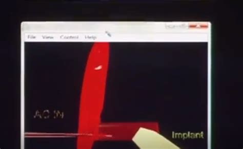Ionic Ear What Happened After Shark Tank Sharktankwiki