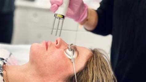 Pico Genesis™ Mampu Mengatasi Hal Berikut Ini Heystetik