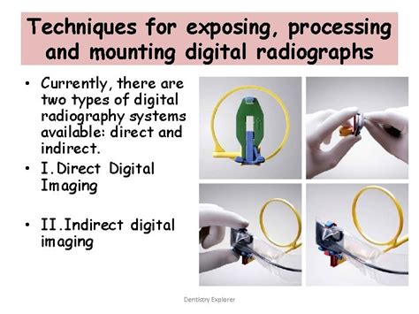 Digital Radiography Department Of Oral Medicine Radiology Dentistry