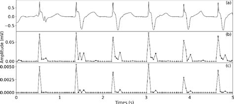 Figure 1 From Ecg Enhancement And R Peak Detection Based On Window