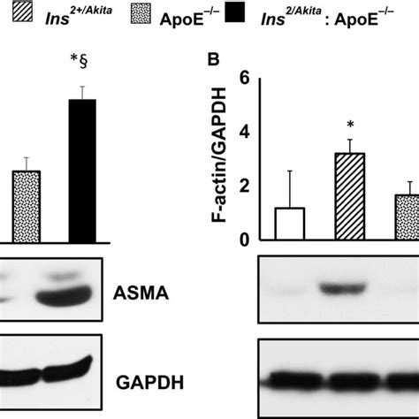 Expression Of Smooth Muscle α‐actin And F‐actin Western Analysis Of Download Scientific