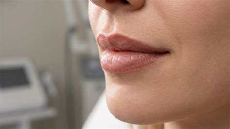 How Long Masseter Botox Takes To Work Results Timeline And What To Expect