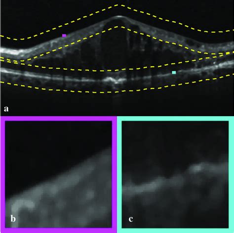 Patch Extraction A Input B And C Patch Examples Extracted From Download Scientific
