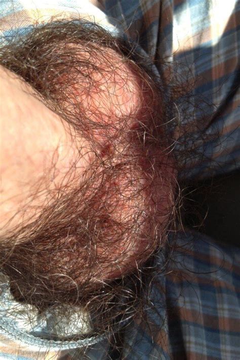 Hairy Balls Runaniru