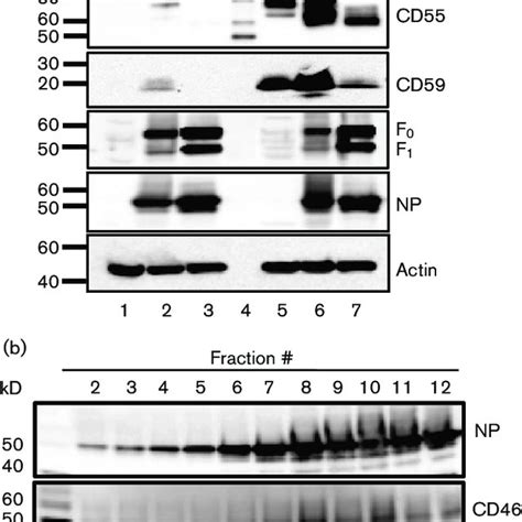 PDF CD55 Is A Key Complement Regulatory Protein That Counteracts Complement Mediated