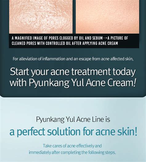 Shop Pyunkang Yul - Acne Cream | Stylevana