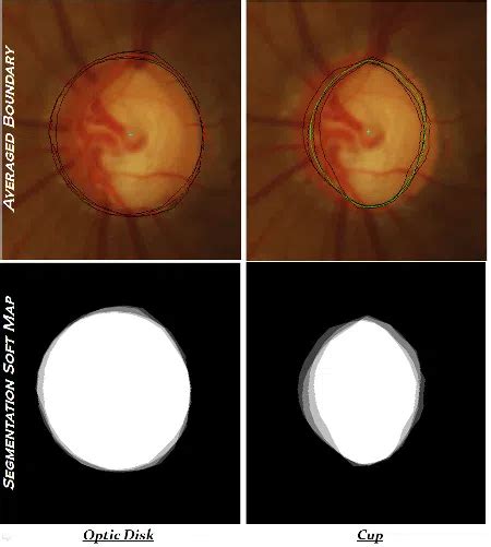 fig 3 sample markings and soft segmentation maps top row 4 expert