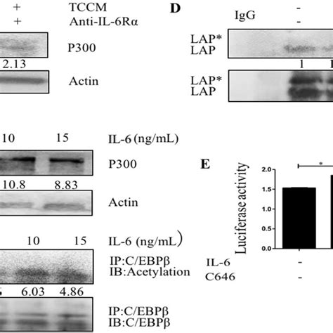 Logical Diagram Of The Regulatory Role Of P300 Mediated Cebpβ