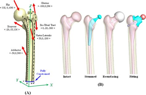 The Finite Element Models Used In This Study A The Model With Hip Download Scientific