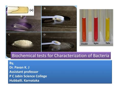 Biochemical Tests For Characterization Of Bacteria Pdf