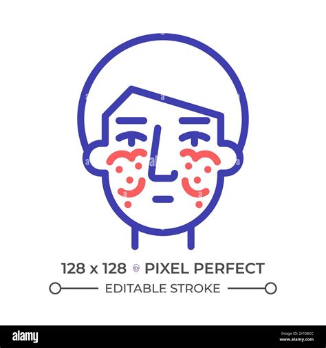 Lupus Rash Two Color Line Icon Stock Vector Image And Art Alamy