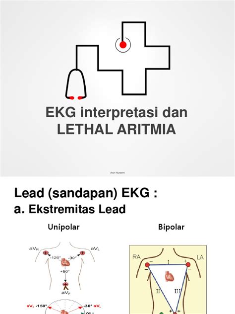 Ekg Lethal Pdf Electrocardiography Heart Rate