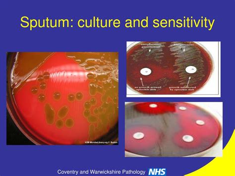 Ppt Pneumonia Sahd Powerpoint Presentation Free Download Id6385114