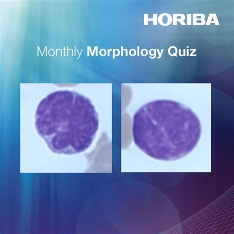 Cell Morphology Quiz Male Patient With Multiple Cells Horiba Uk Limited Posted On The Topic