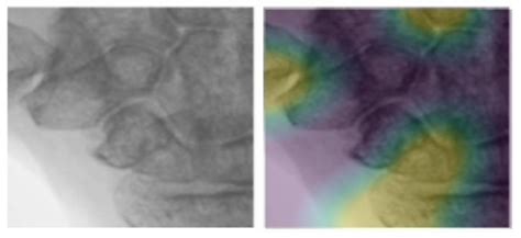 Explanation Of The Model Compared With The Heatmap For The Download Scientific Diagram