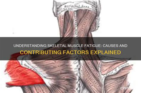 Understanding Skeletal Muscle Fatigue Causes And Contributing Factors Explained Cyvigor