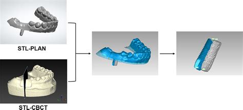 Flowchart Of The Conventional Radiographic Method Download Scientific