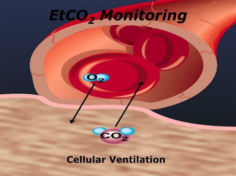 Ppt End Tidal Co Etco Monitoring Powerpoint Presentation Free Download Id