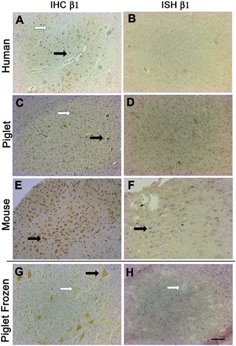 Protein Ihc And Mrna Ish Expression Of 1 Nachr Subunit In The Brain
