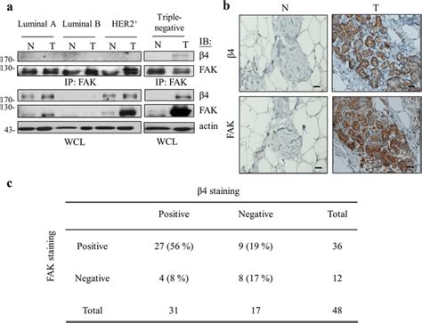 A Positive Correlation Between β4 Integrin And Fak Expression In