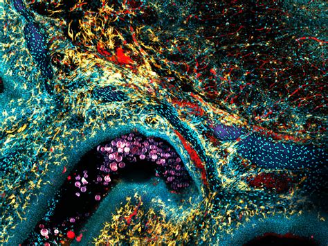 Fungal Glucans Reprogram And Inflammatory State In Sepsis Interviews