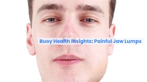 Painful Jaw Lumps Common Causes And When To Seek Medical Care