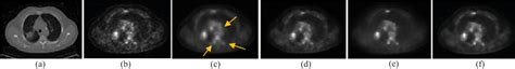 Figure 1 From Median Non Local Means Filtering For Low Snr Image
