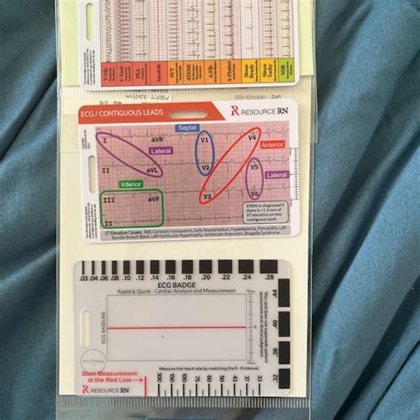Ekg Stemi Reference Tool Horizontal And Vertical Badge Card Pocket Guide Etsy