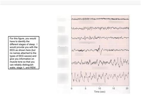 Eeg Image Diagram Quizlet Eeg Image Diagram Quizlet
