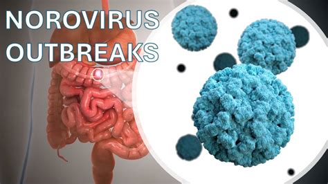 Norovirus Y Calicivirus Youtube