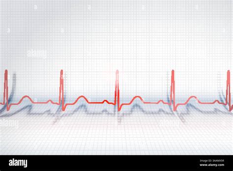 red line of ecg chart on the background of bended plotting paper