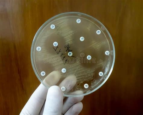 Antimicrobial Susceptibility Testing Stock Image Image Of Laboratory Closeup 275614973