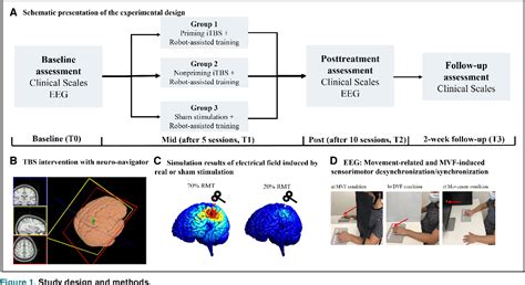 Figure 1 From Priming Intermittent Theta Burst Stimulation For