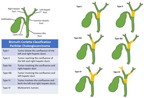 Cancers Free Full Text Current Perspectives On The Surgical