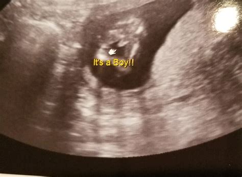 How Many Weeks Can I Find Out Gender Of Baby Baby Viewer