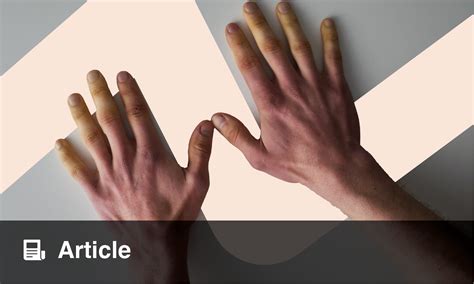 Systemic Sclerosis Ssc Review Rheumatology Emj Reviews