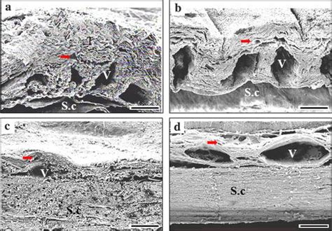 Scanning Electron Micrograph Of A Cut Surface Of The Choroid In Donkeys Download Scientific