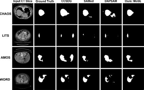 [pdf] Mixture Of Shape Experts Mose End To End Shape Dictionary Framework To Prompt Sam For