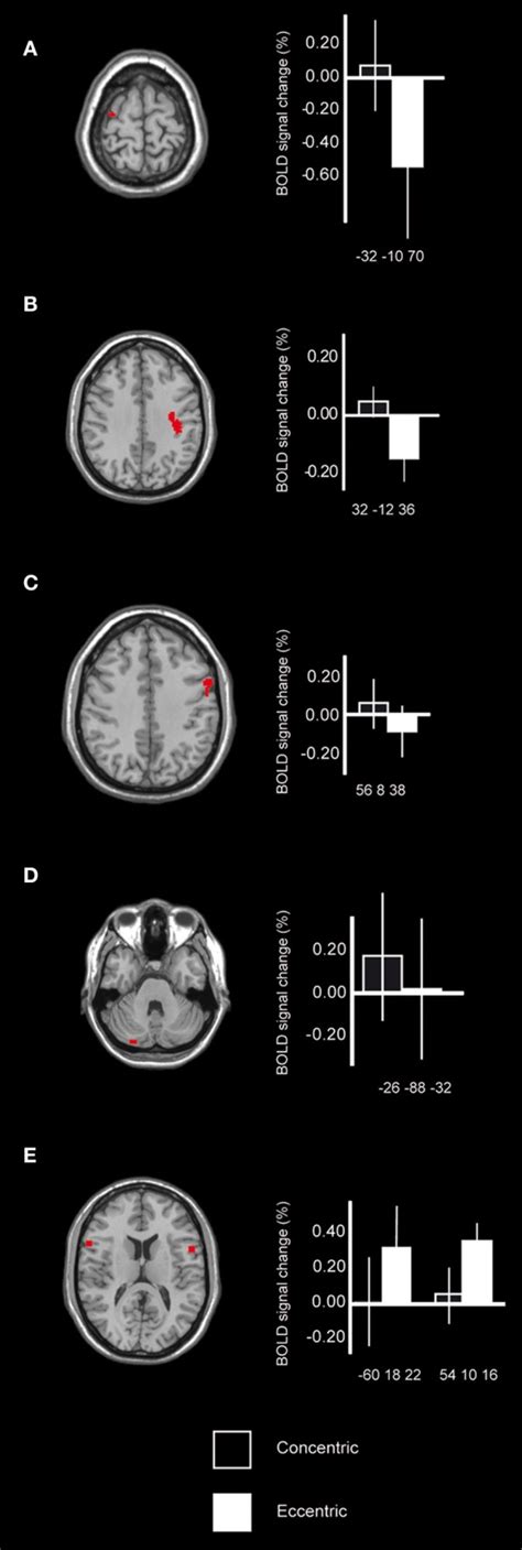Cortical Activation Differences While Contrasting Simulated Maximum